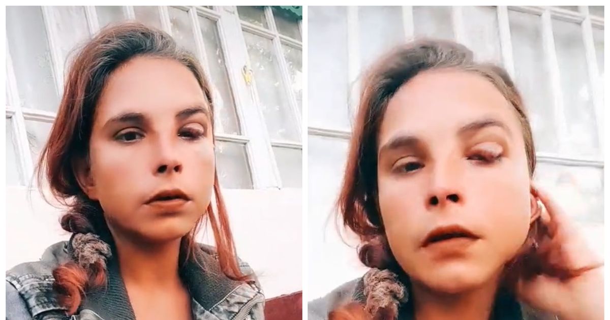 Alexandra Bodi a fost bătută?! S-a filmat pe Tik Tok cu ochiul vânăt ...