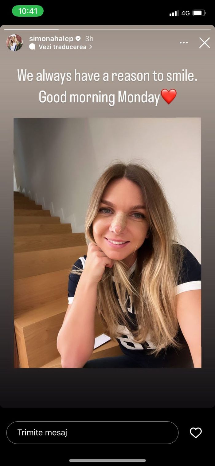 Simona Halep, mesaj neașteptat pe Instagram, după operația estetică la ...