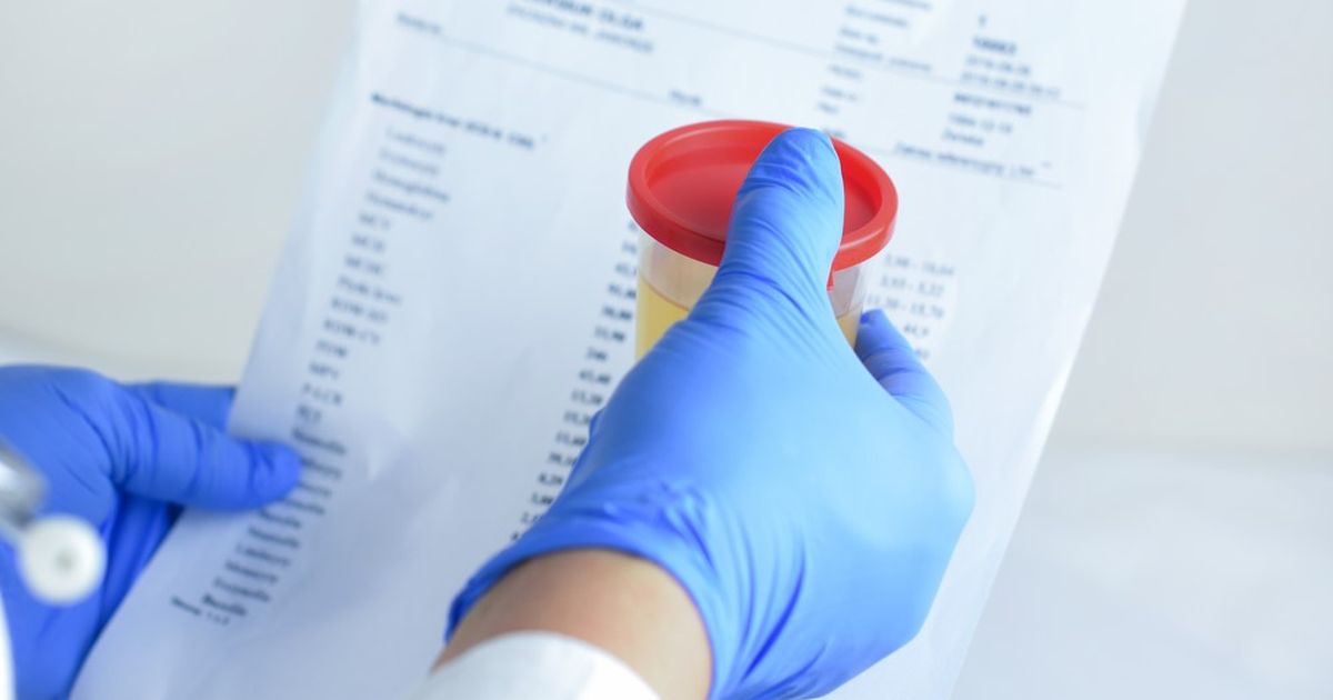 Ce trebuie să știi despre sumarul de urină? - WOWBiz