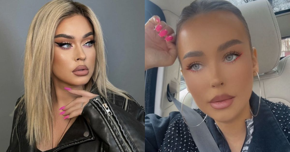 „Altă șansă nu aveam” Misha a ajuns pe mâinile medicilor! Cu ce ...