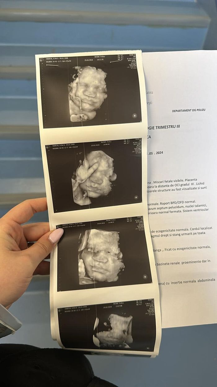 George Simion a publicat prima fotografie cu bebelușul: "Seamănă cu ...