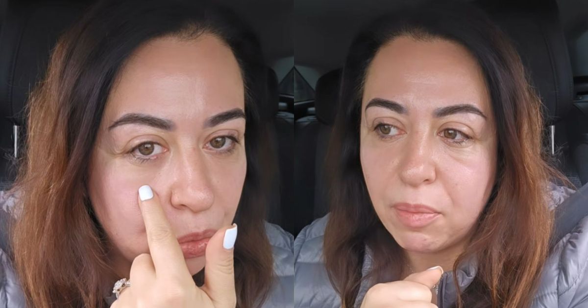 Oana Roman a tras un semnal de alarmă după ce s-a trezit cu un ochi ...