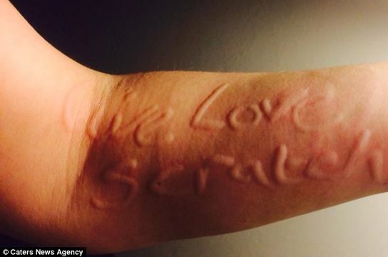 Femeia care sufera de o boala rara ce ii permite sa isi deseneze orice ...