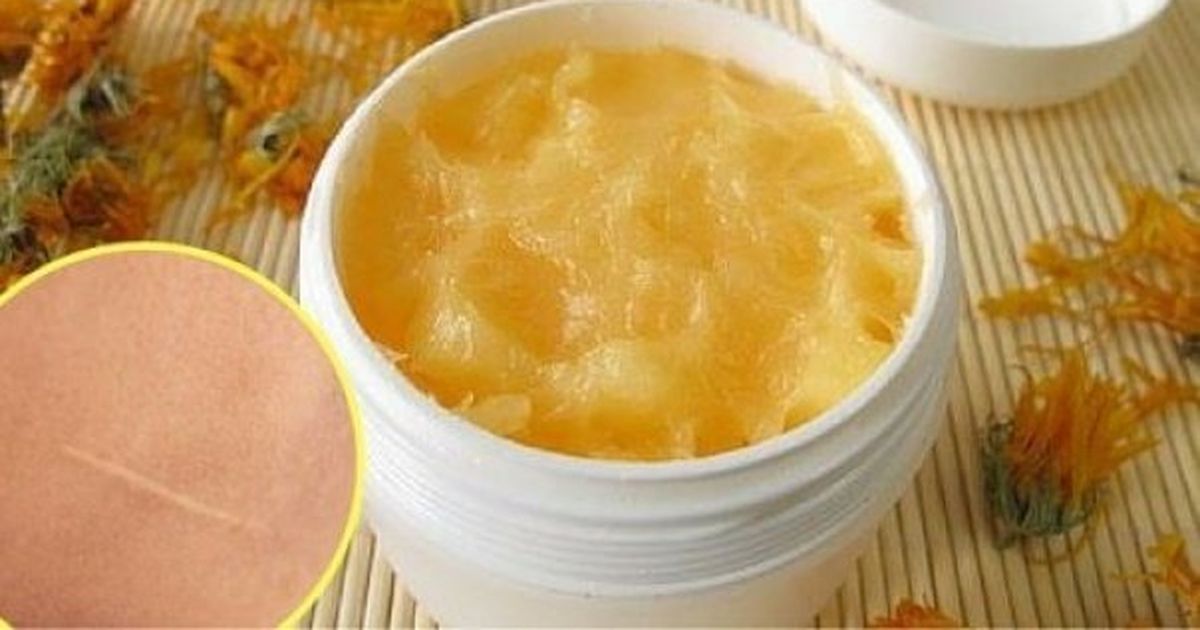 Crema naturala care vindeca RAPID taieturile si cicatricile - WOWBiz