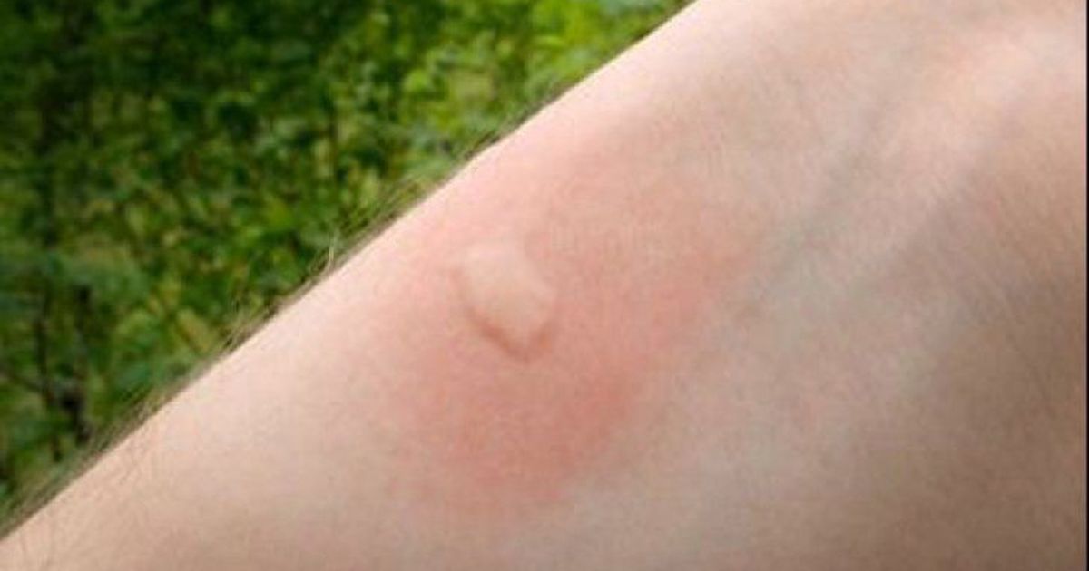 Tantarii ucid anual 1 milion de oameni. Cele mai periculoase specii ...