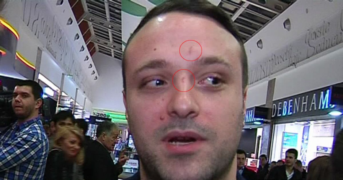 Andrei Tardea tantos la un eveniment monden cu fata plina de zgarieturi ...