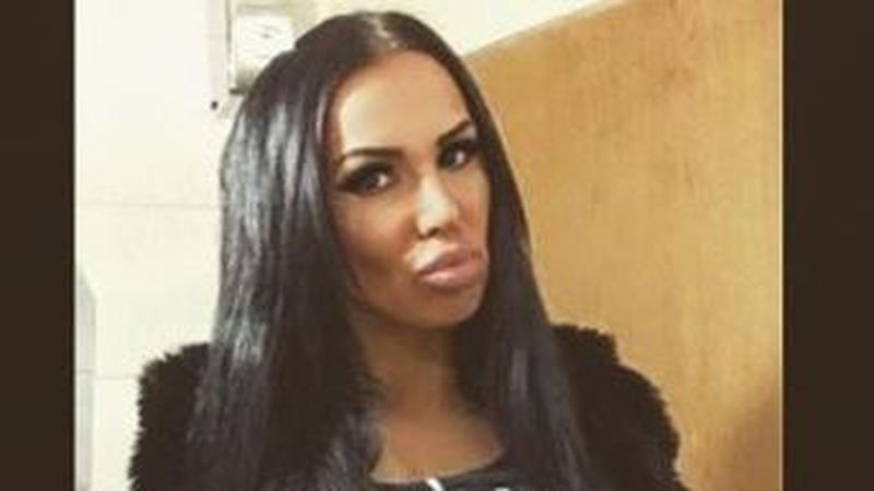 WOW! Cum arata 'Spintecatoarea de la morga' dupa 3 operatii de ...