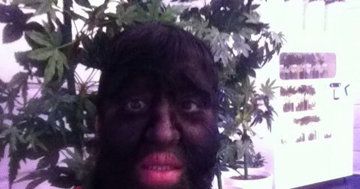 Cum arata astazi Omul lup pe care l-ati vazut la WOWbiz! - WOWBiz