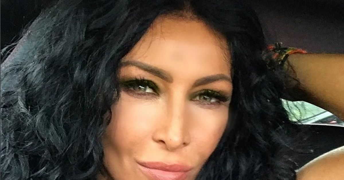 Ce s-a intamplat cu chipul Mihaelei Radulescu! A mers la estetician si si-a taiat... - WOWBiz