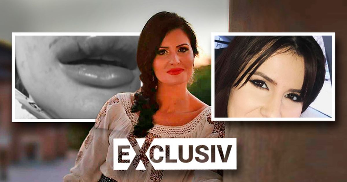 Cum arata Geanina Manea dupa ce a fost muscata de buza de un caine ...