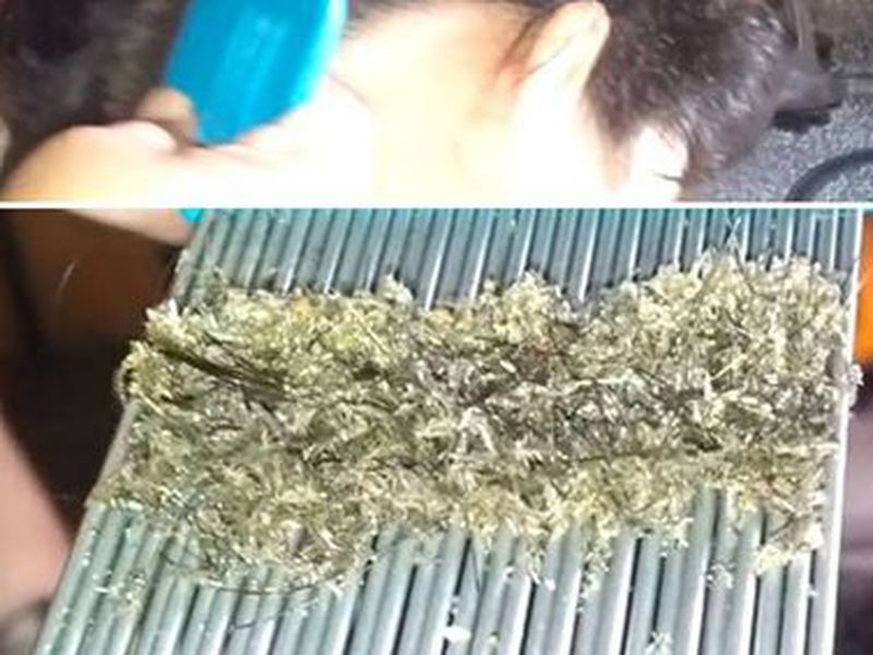 E cel mai grav caz de infestare cu paduchi! Te ia cu rau la stomac cand ...