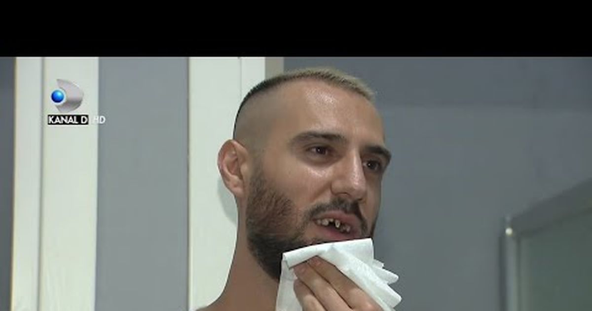 Reactie Andreea Pirui dupa ce Marius a ramas fara dinti - WOWBiz