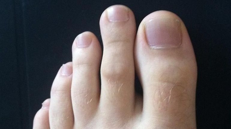 Ai al doilea deget de la picior mai lung decat primul, ca in poza? Din
