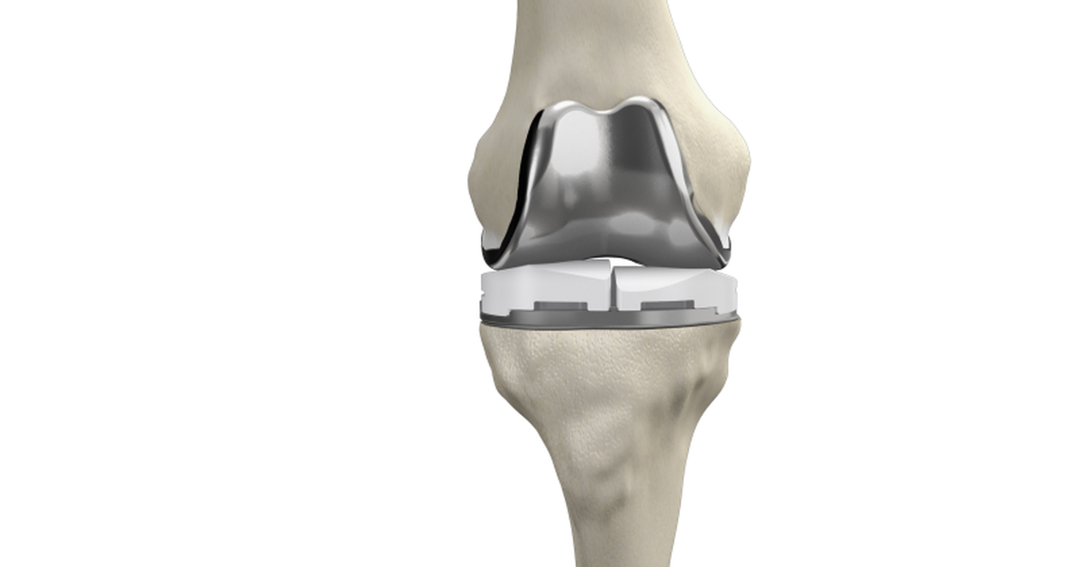 Gonartroza: ce este si cum se trateaza? - Kanal D Romania