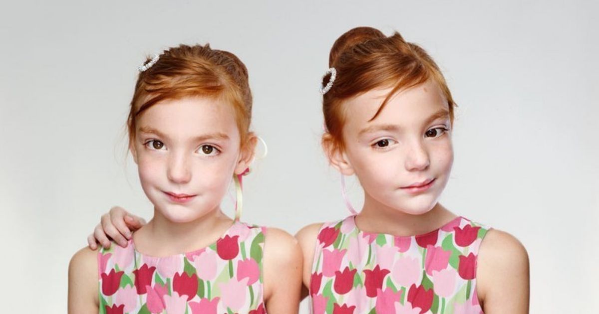 Exista diferente ale aspectului fizic intre gemenii identici? Descopera ...