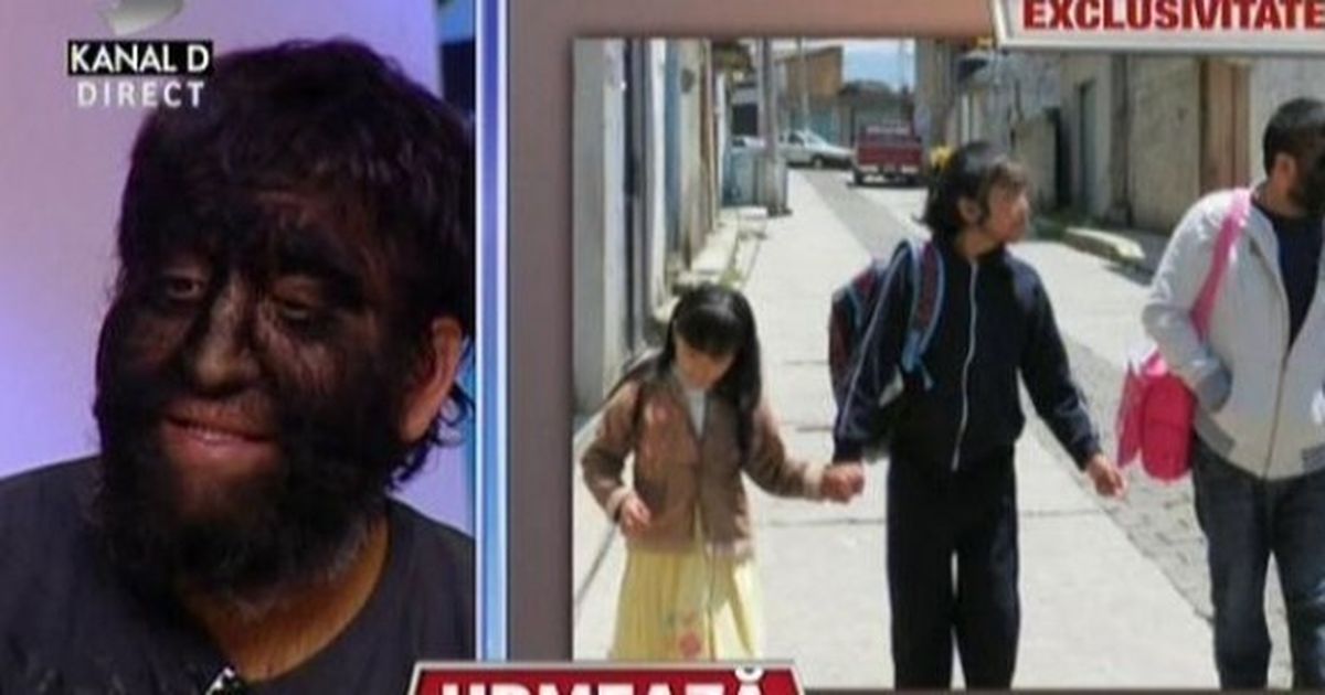 "Omul-Lup" a venit la WOWbiz! Afla-i povestea incredibila - La 13 ani a ...