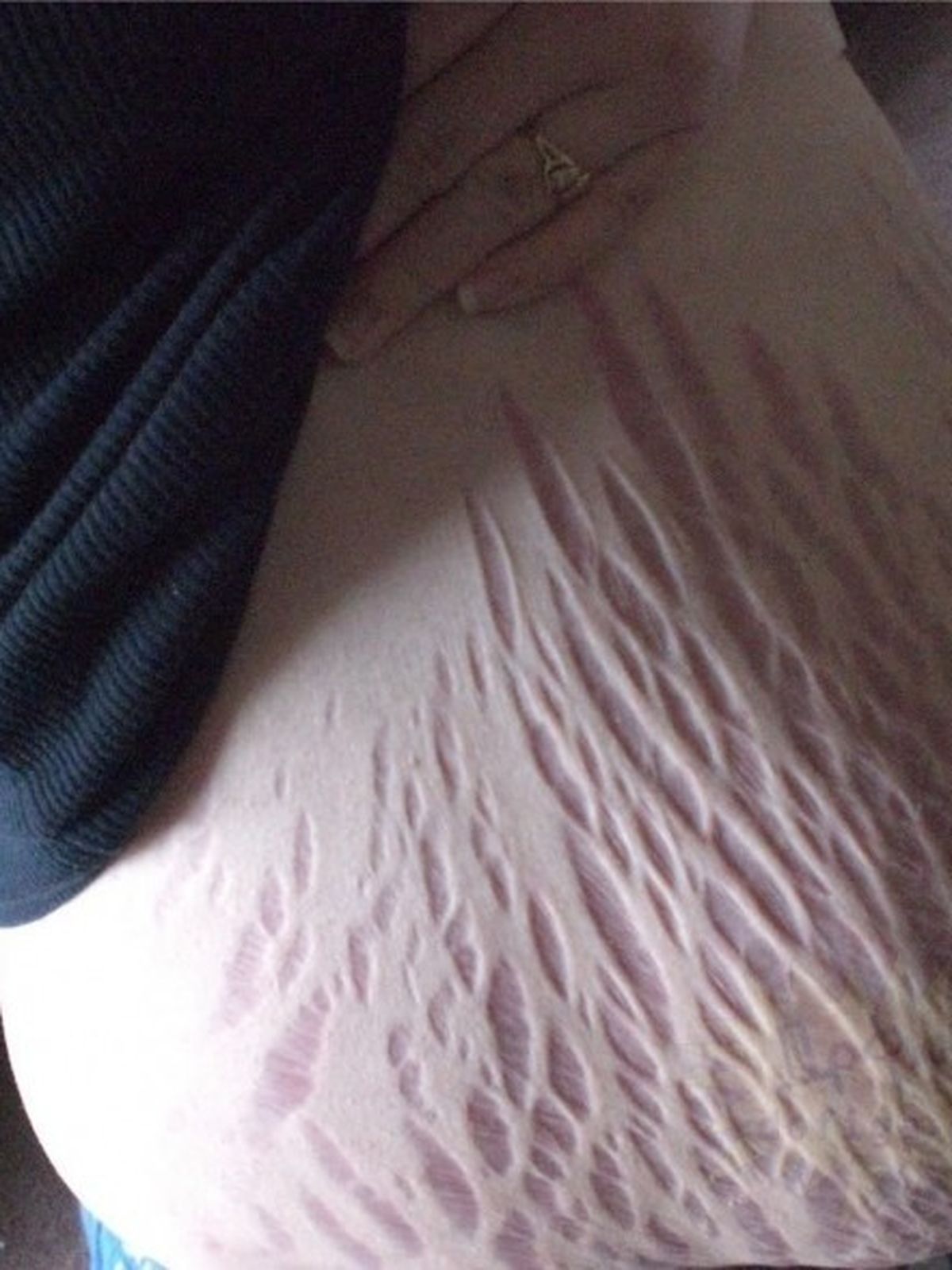 IMAGINI HORROR: A fost INSARCINATA, insa nu s-a dat cu ulei pentru a ...