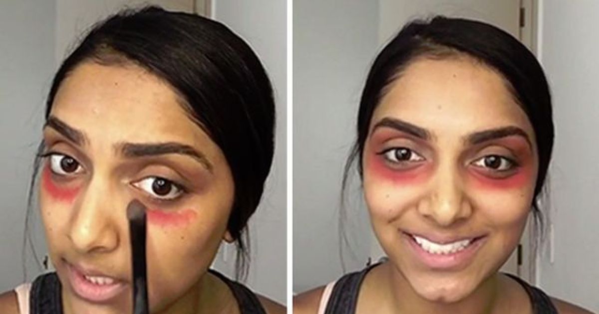 Si-a dat cu ruj portocaliu pe sub ochi si l-a intins cu pensula! Pare ...