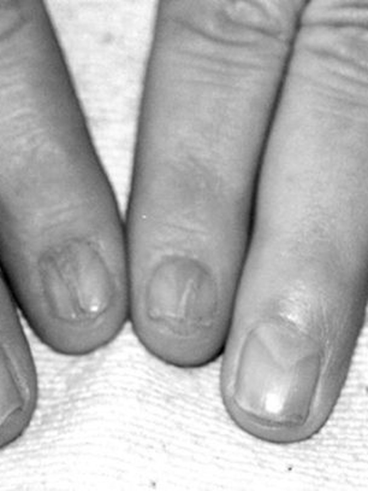 Ai asa ceva la baza unghiei, pe degete? Se numeste "lunula" si ...