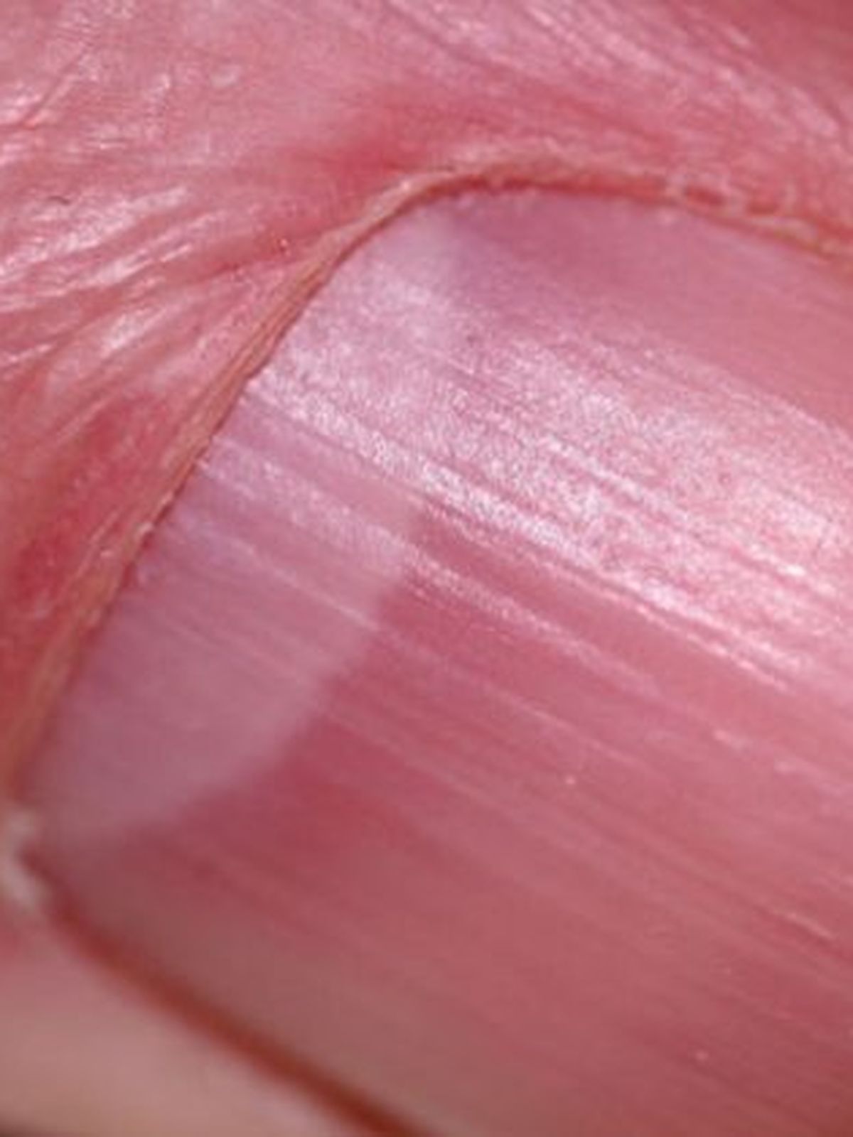 Ai asa ceva la baza unghiei, pe degete? Se numeste "lunula" si ...