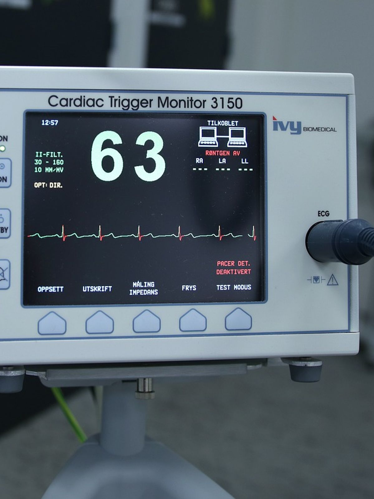 EKG-ul: ce este electrocardiograma si cand se recomanda? - Kanal D Romania
