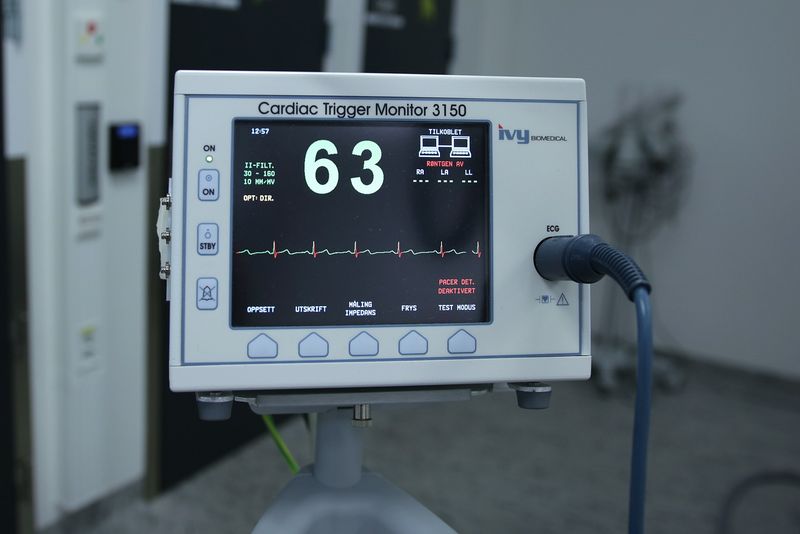 EKG-ul: ce este electrocardiograma si cand se recomanda? - Kanal D Romania