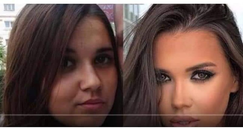 Andra Volos inainte de operatiile estetice - Kanal D Romania