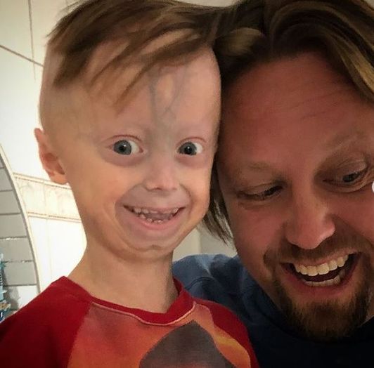 VIDEO| Povestea tragică a copilului de șase ani care arată ca un bărbat ...