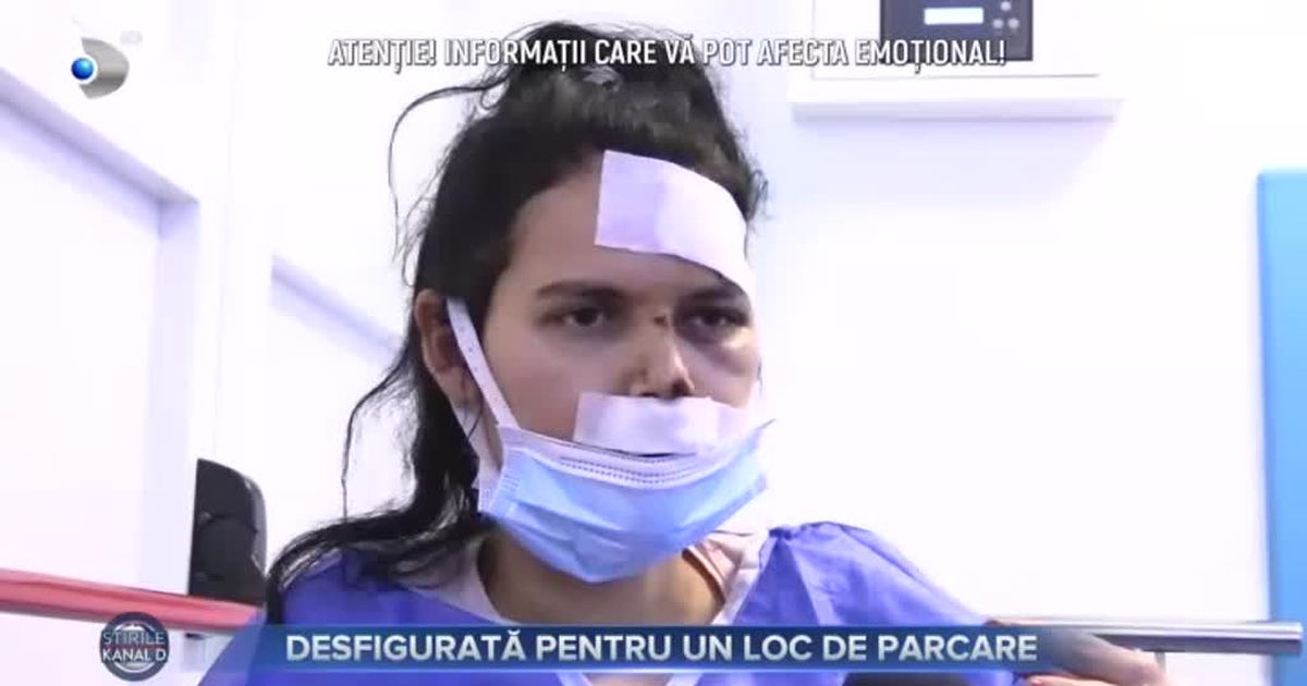 Desfigurată pentru un loc de parcare - Stirile Kanal D