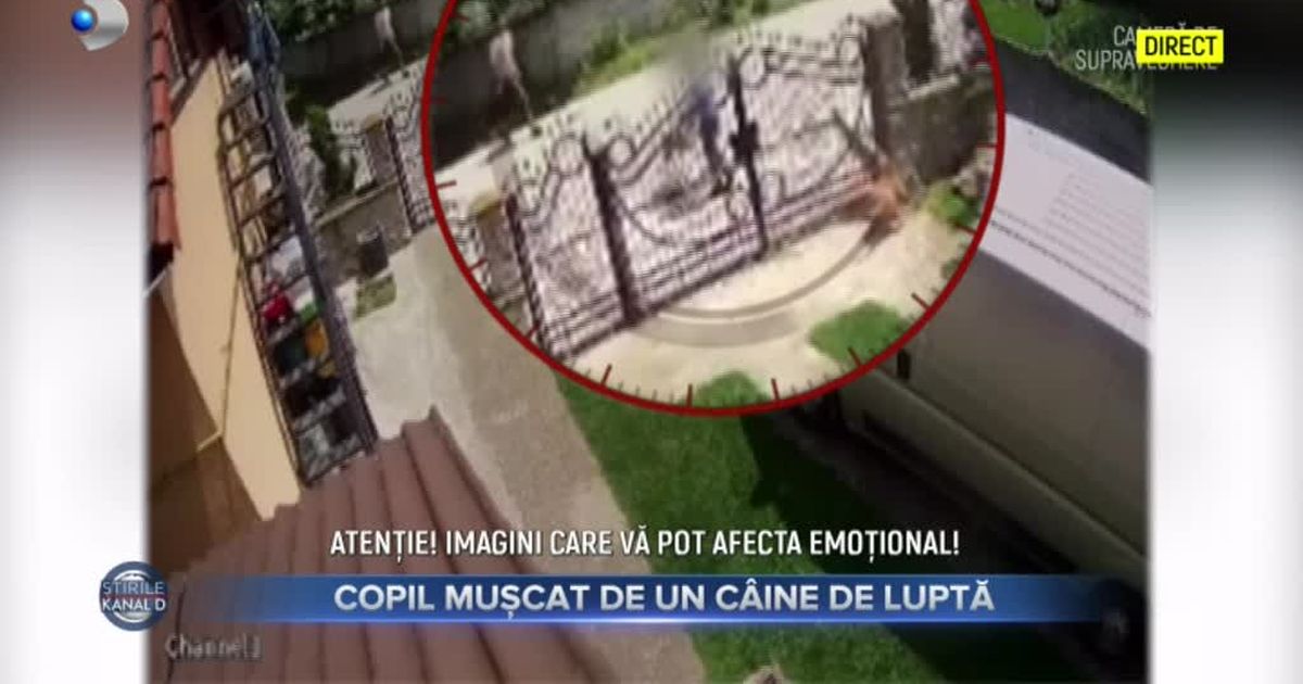 Copil mușcat de un câine de luptă - Stirile Kanal D