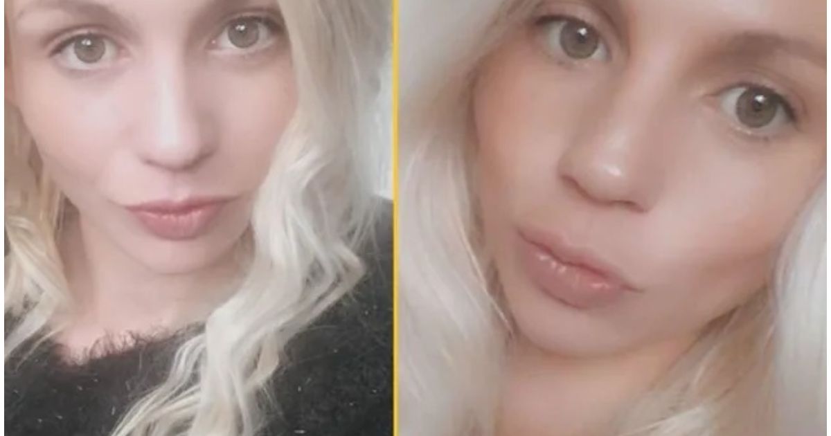 Mămica a cinci copii a încercat să-și scoată singură dinții după ce a ...