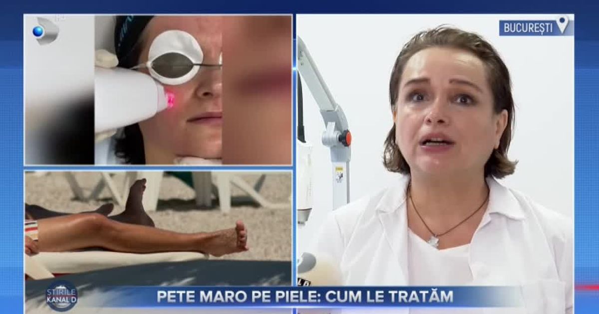 VIDEO - Petele pe piele: de ce apar și cum le putem trata? „Petele ...