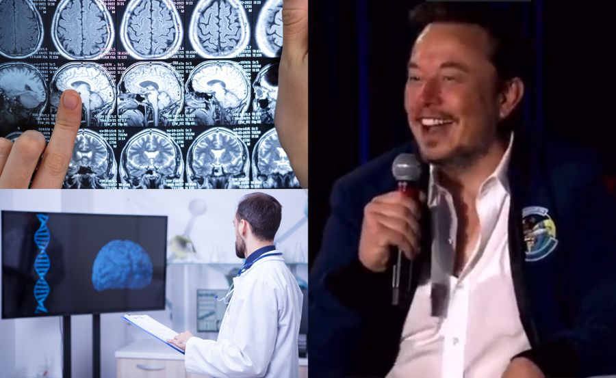 Experimentele pe creierul uman au fost aprobate. Elon Musk poate începe ...