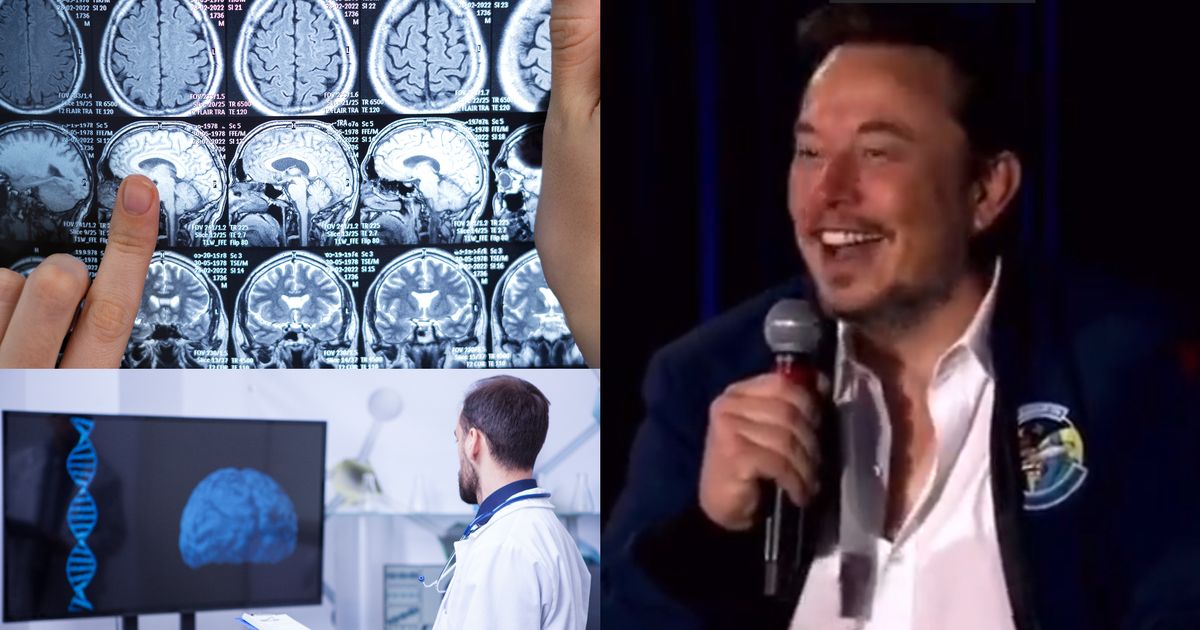 Experimentele pe creierul uman au fost aprobate. Elon Musk poate începe ...