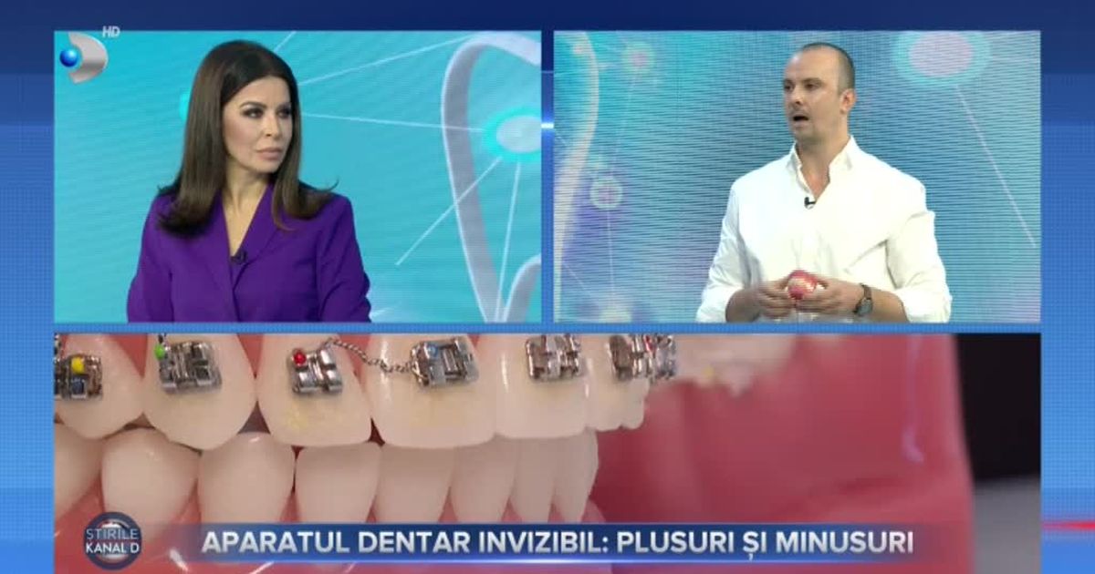 VIDEO - Aparatul dentar invizibil: plusuri și minusuri. „Aparatul ...