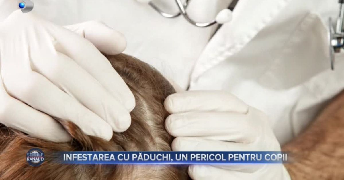 VIDEO - Infestarea cu păduchi, un pericol pentru copii. „Pediculoza și ...
