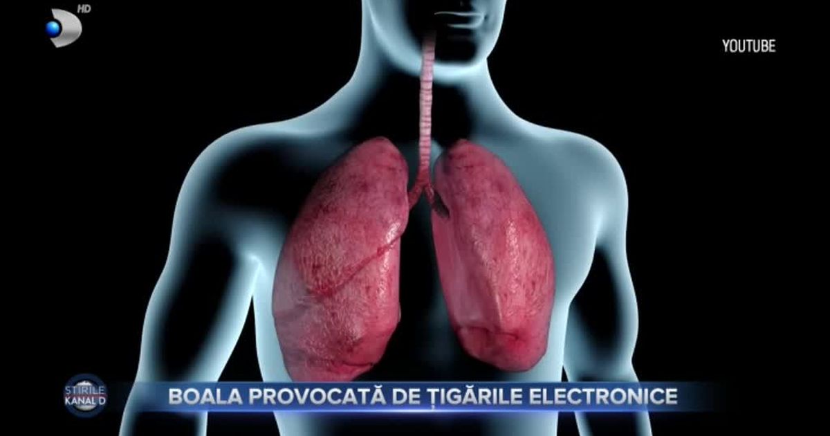 VIDEO- Boala provocată de țigările electronice. Afecțiunea Evali, din ...