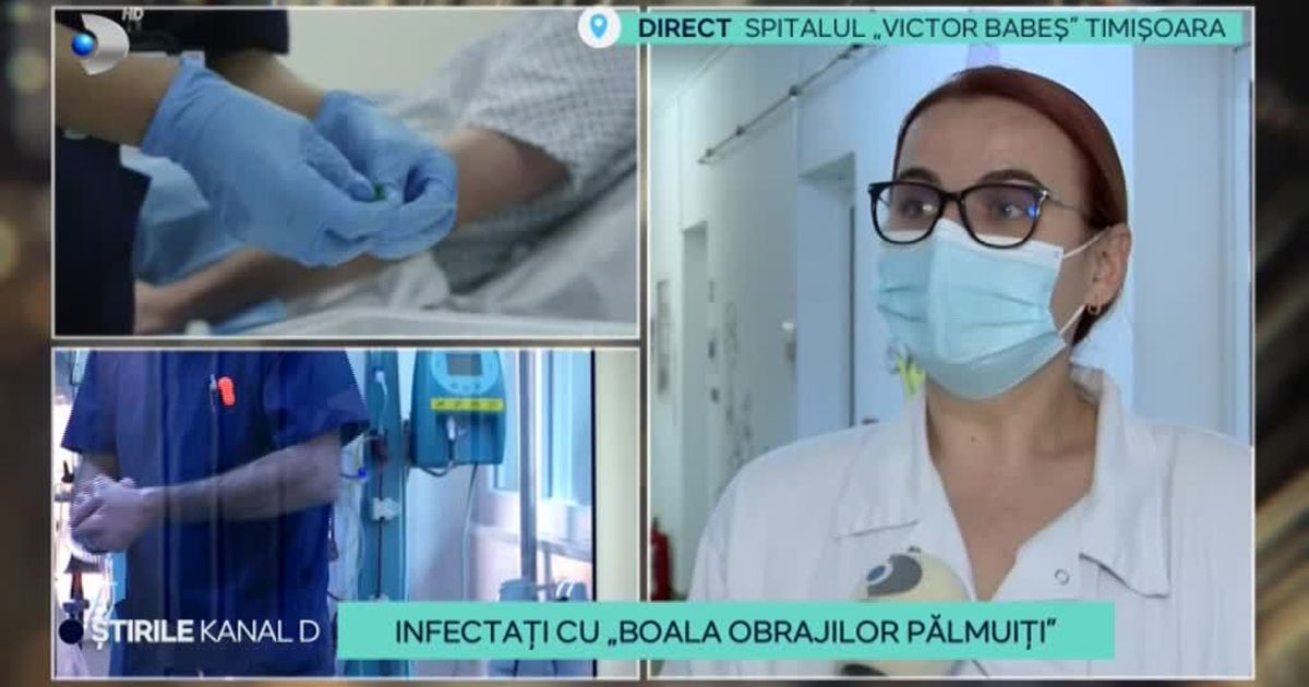 VIDEO-Infectați cu,,Boala obrajilor pălmuiți''. Ce presupune, de fapt ...