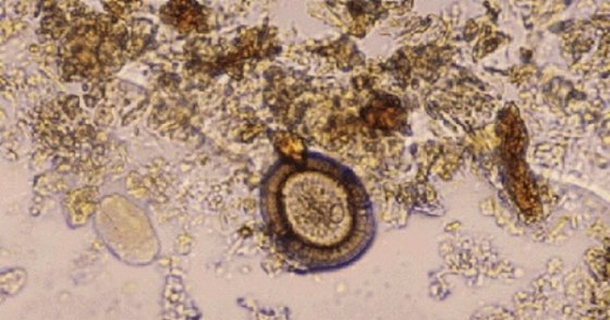 Raportul dezastrului despre apele din Romania! Sunt contaminate cu ...