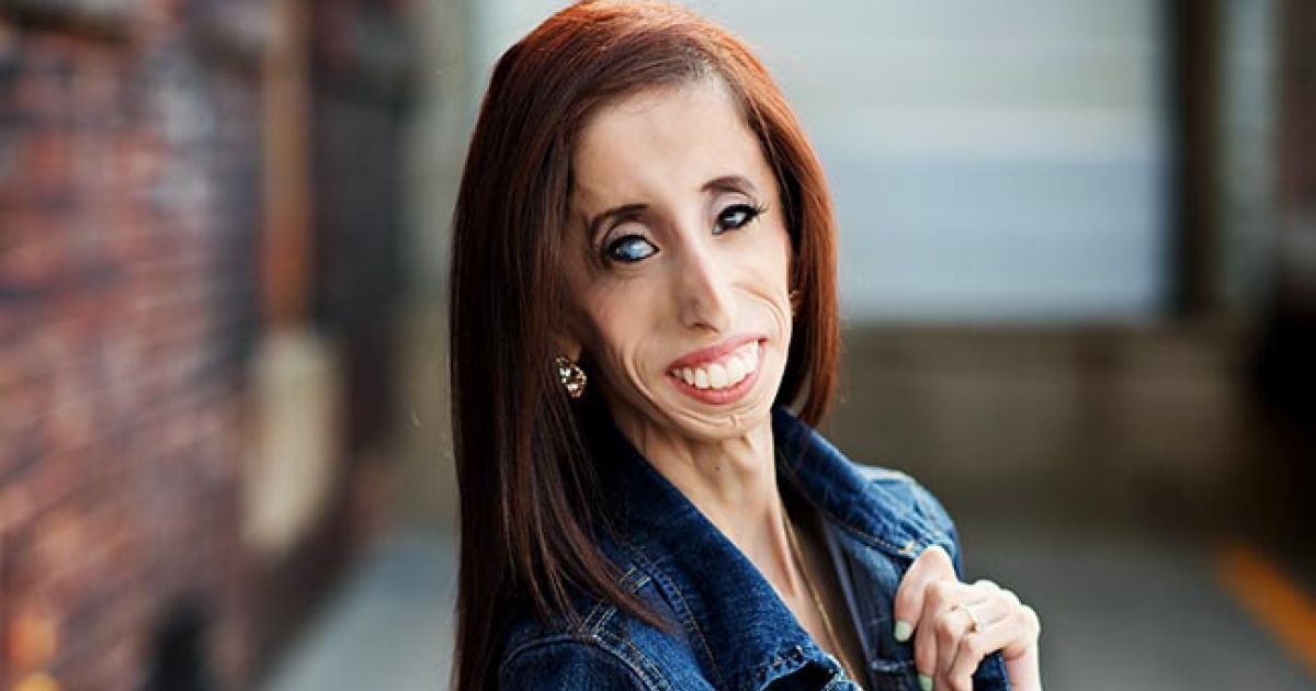 Cum arată acum cea mai urâtă femeie din lume! Are 1 milion de ...