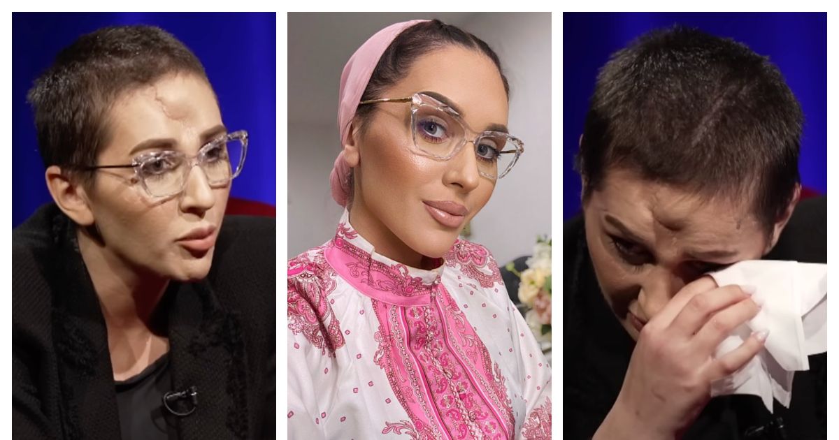 „Sunt sub 2 tratamente, la terapie la mâini am făcut o pauză pentru că ...