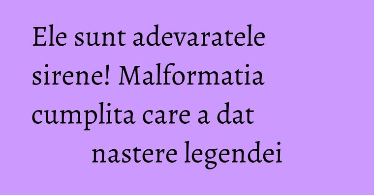 Ele sunt adevaratele sirene! Malformatia cumplita care a dat nastere ...