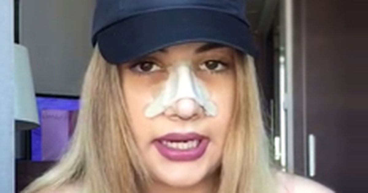 Thalida de la Puterea Dragostei, amănunte despre operația la nas - KFetele