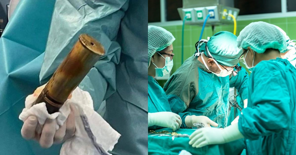 Dimineața Nebună: Un bătrân s-a prezentat la spital cu un obuz înfipt ...